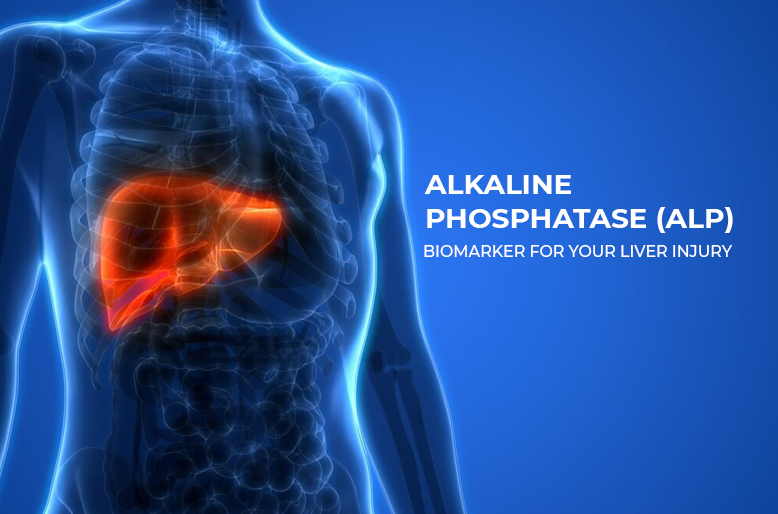 مقدار مجاز Alkaline phosphatase | مقادیر آلکالین فسفاتاز در سنین مختلف